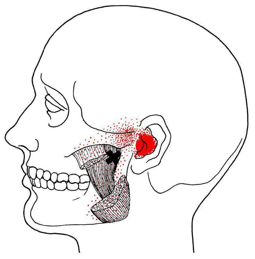 TMJ Self Massage: Massaging Your Masseter Muscle | Restorative Health ...