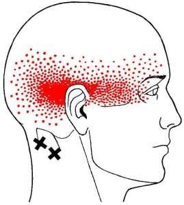 How to Read Without Neck Pain: Practical Posture Tips